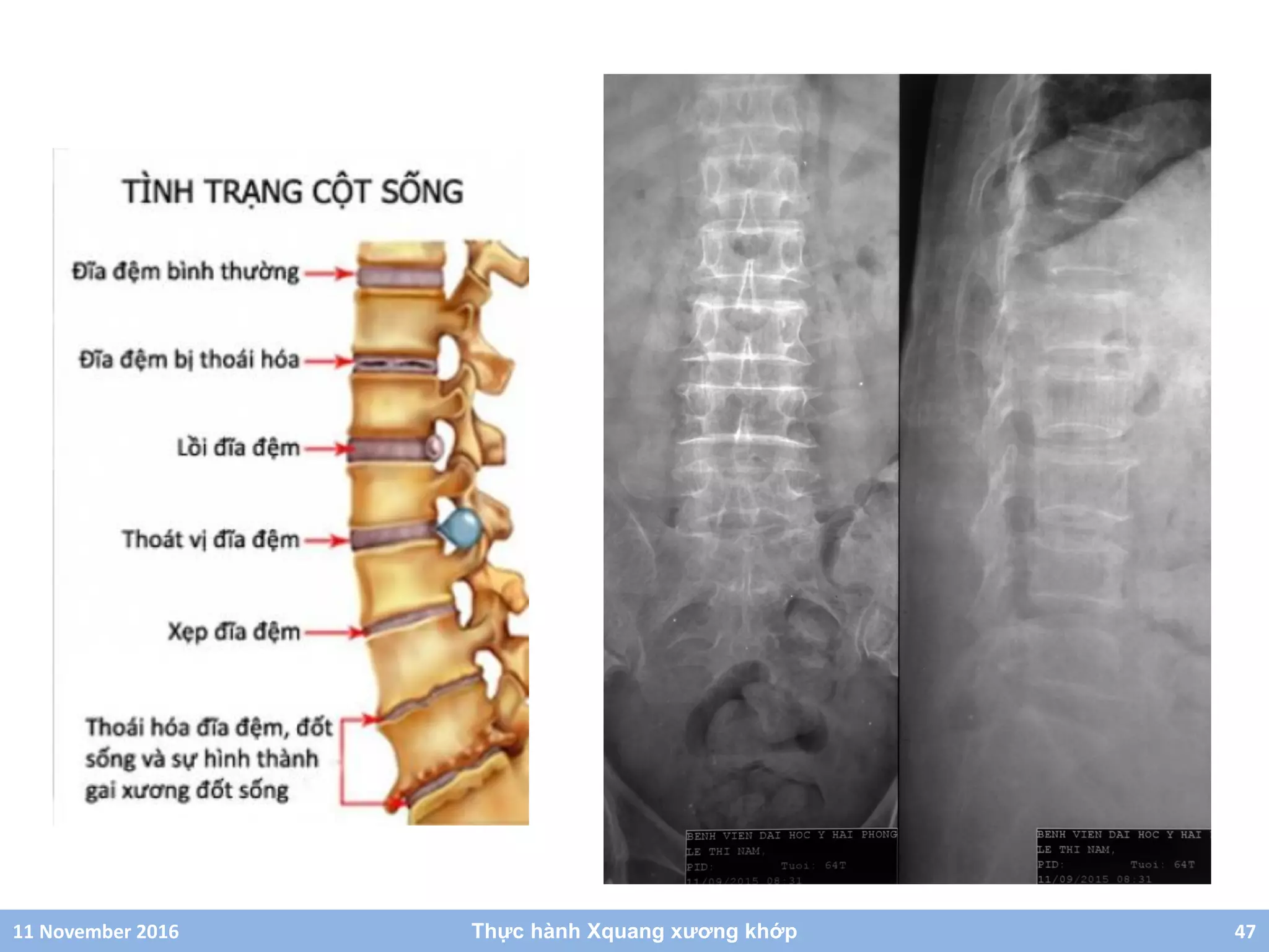 Thực hành X quang xương khớp | PDF