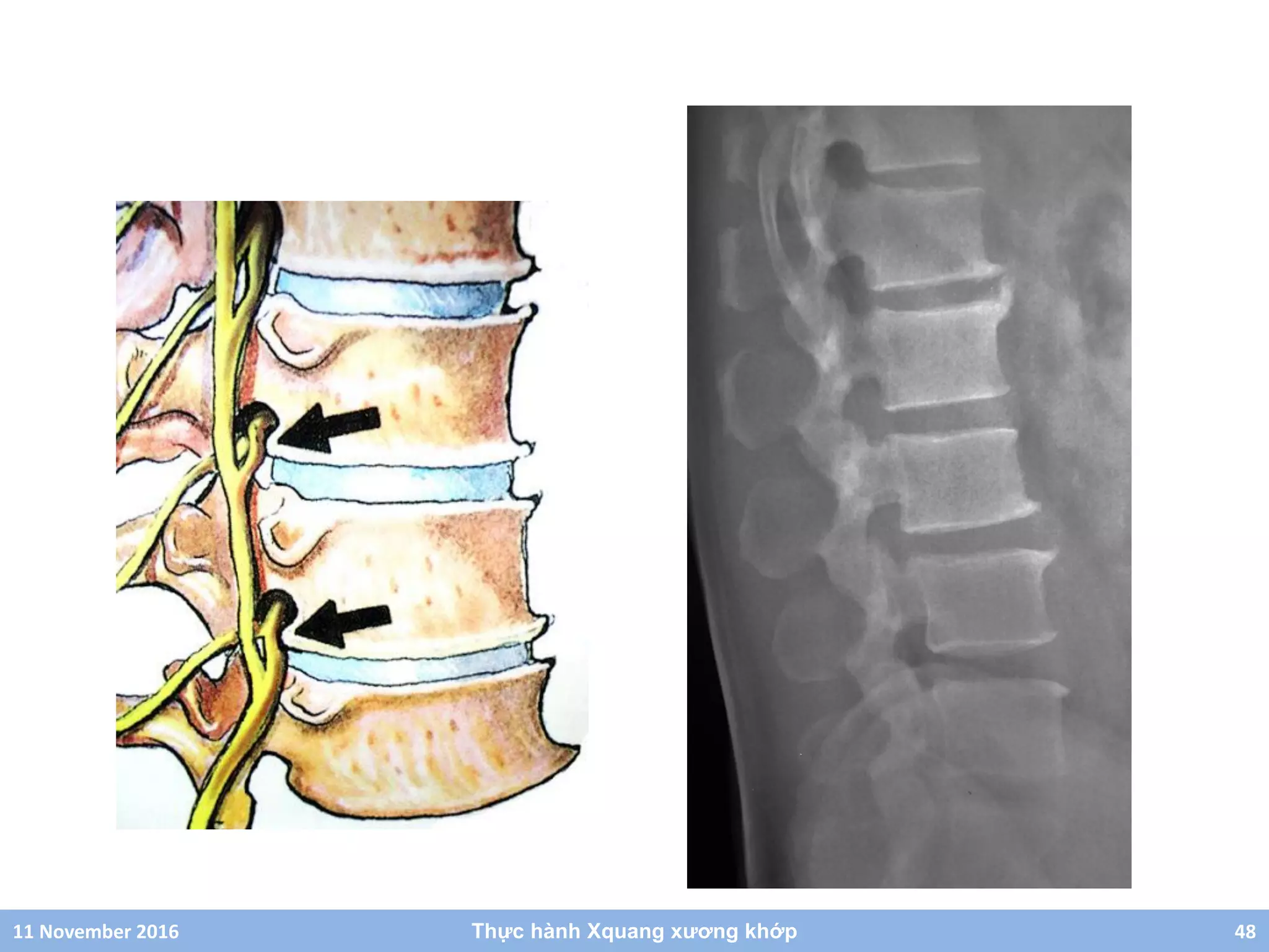 Thực hành X quang xương khớp | PDF