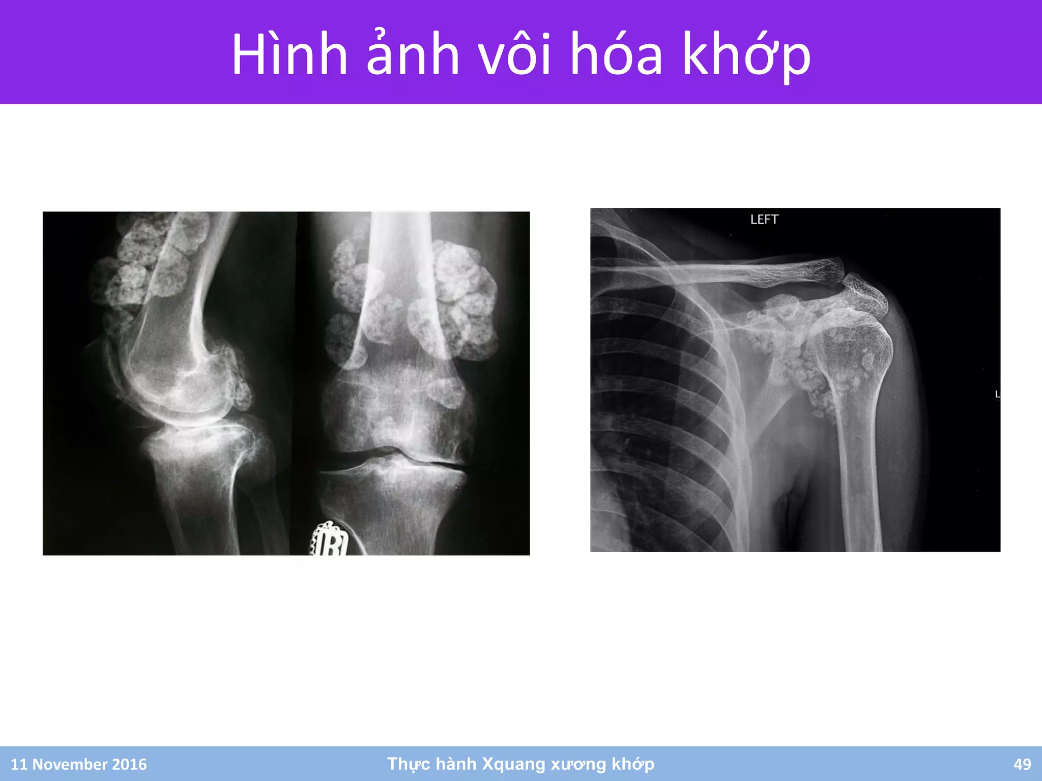 Thực hành X quang xương khớp | PDF