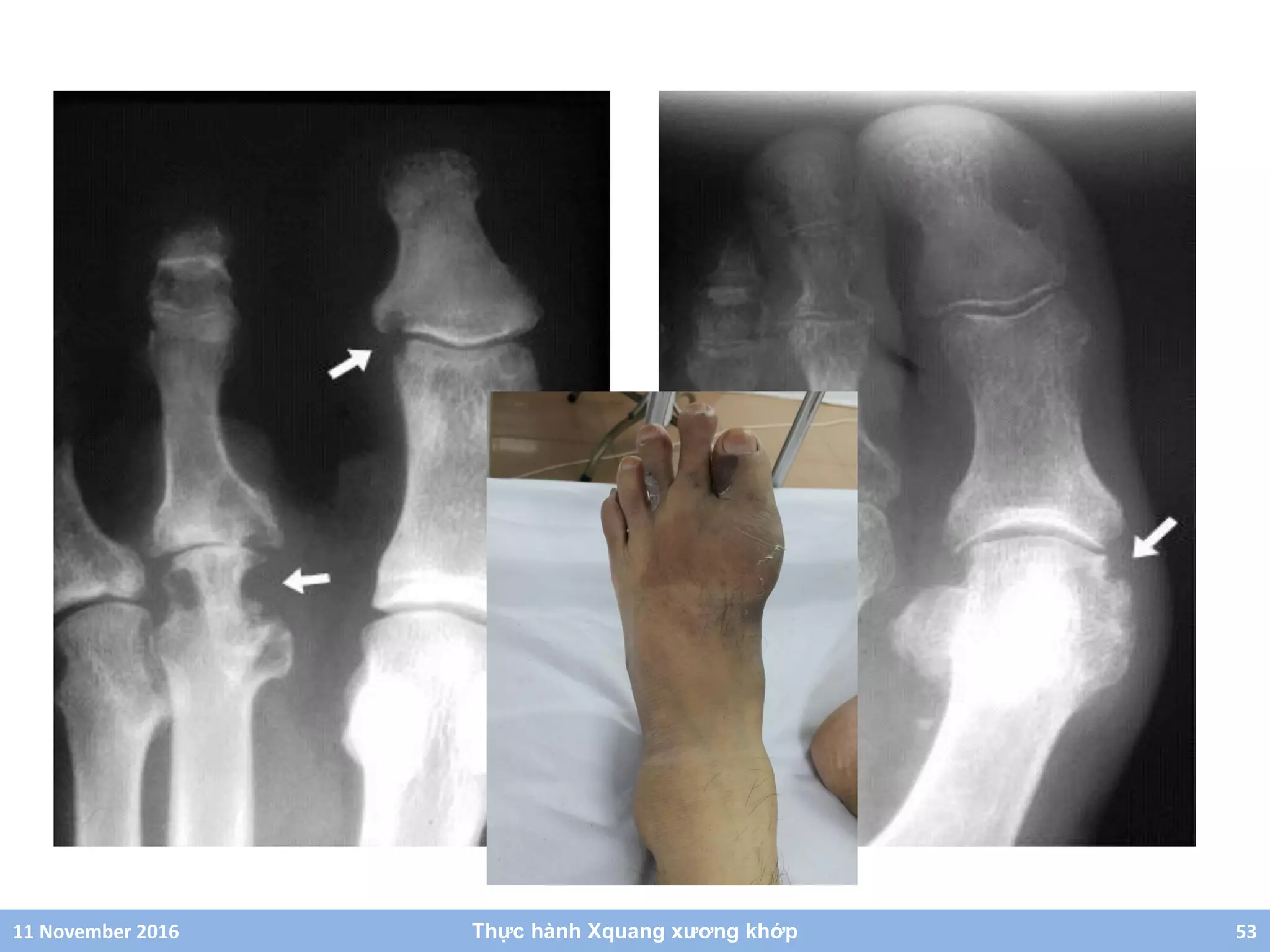 Thực hành X quang xương khớp | PDF