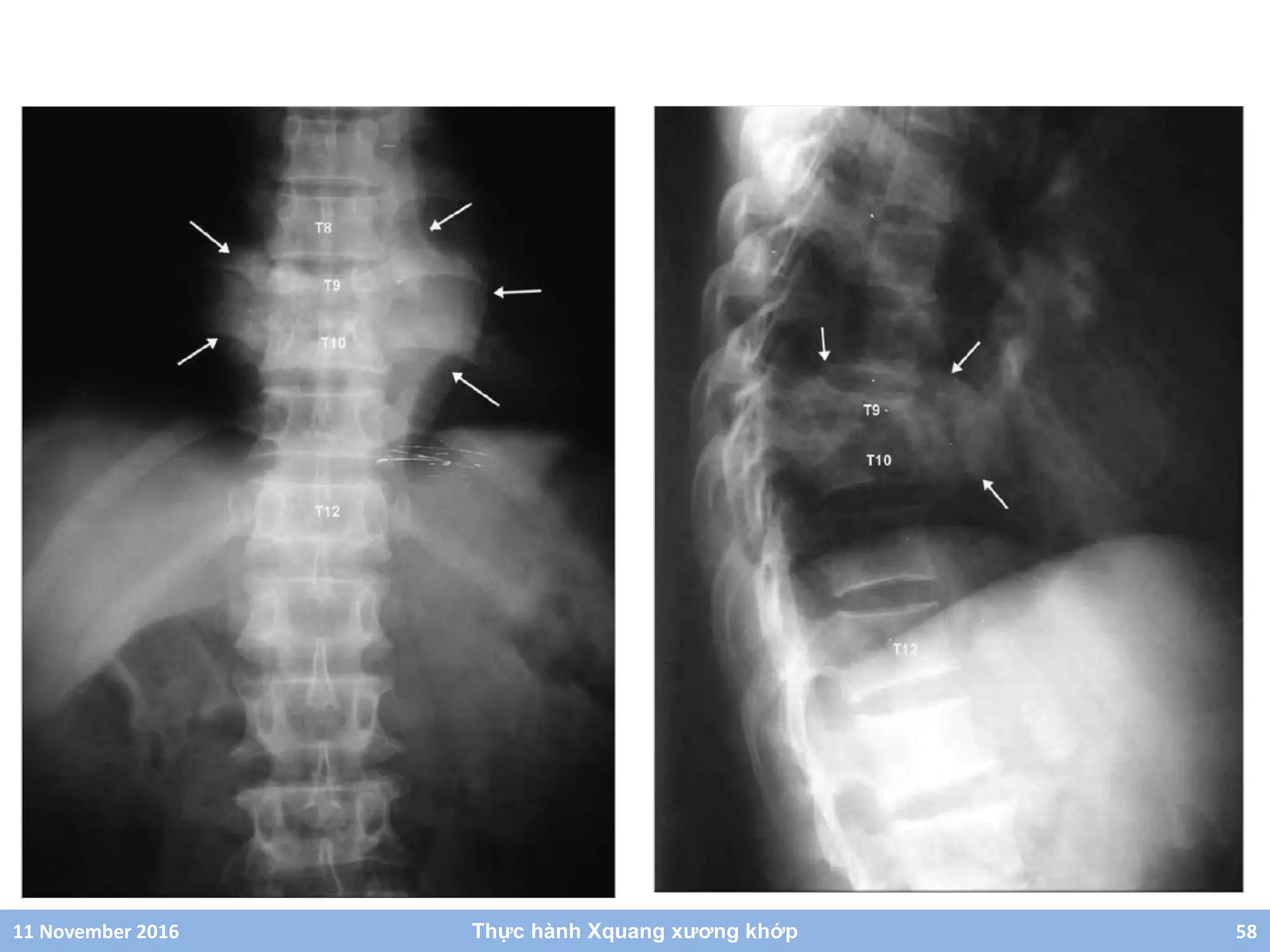 Thực hành X quang xương khớp | PDF