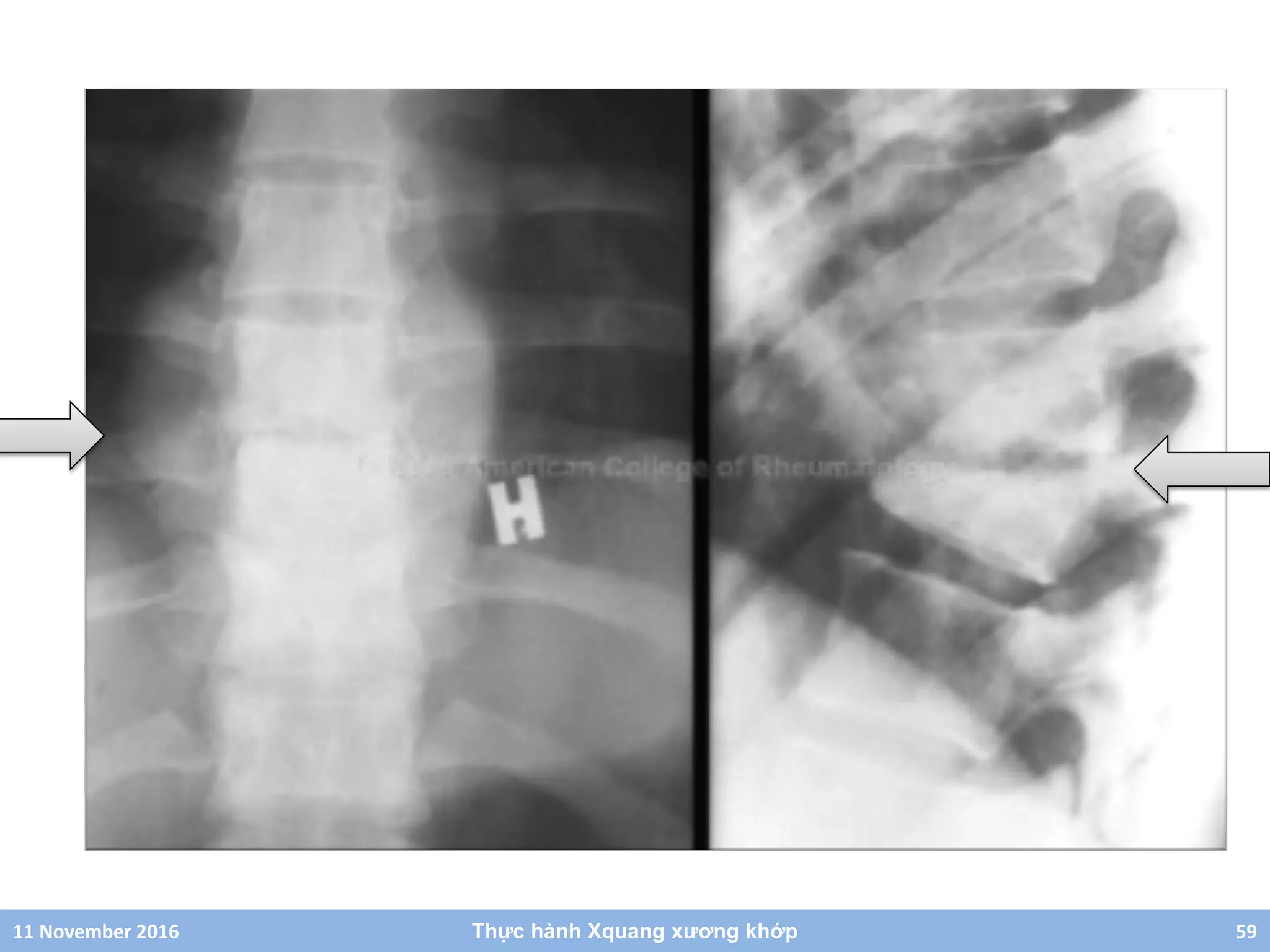 Thực hành X quang xương khớp | PDF