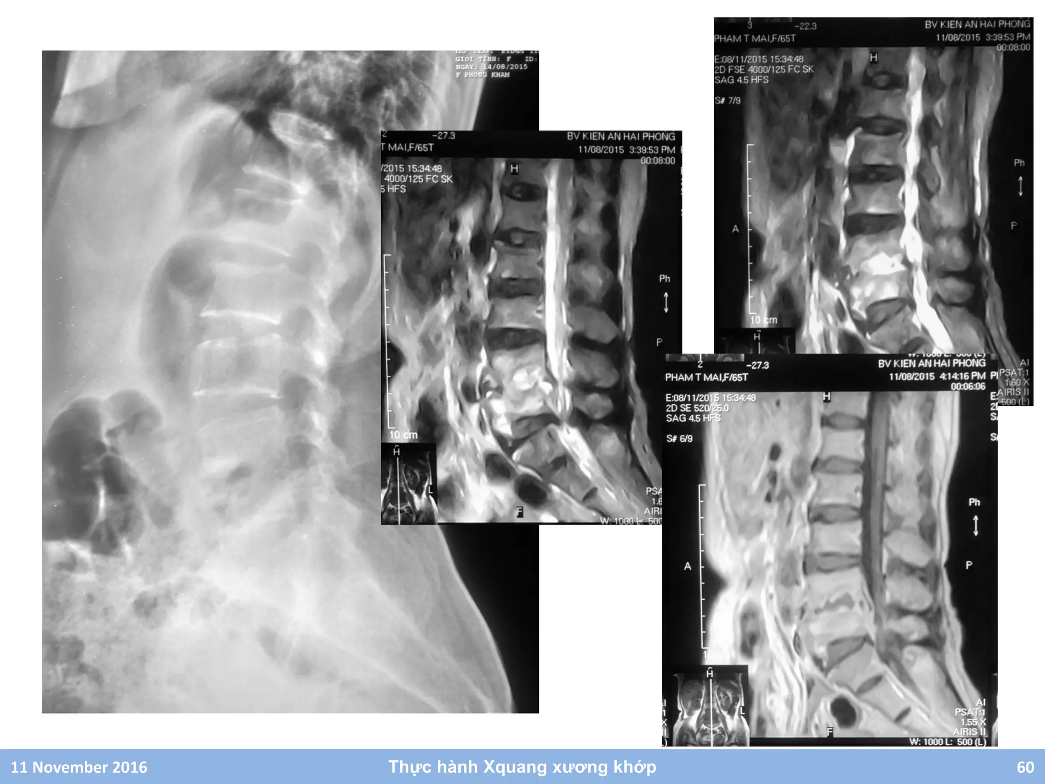 Thực hành X quang xương khớp | PDF