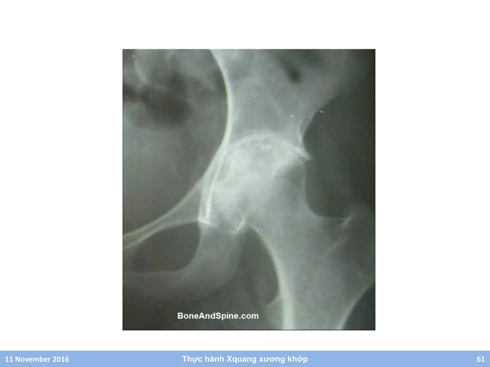 Thực hành X quang xương khớp | PDF