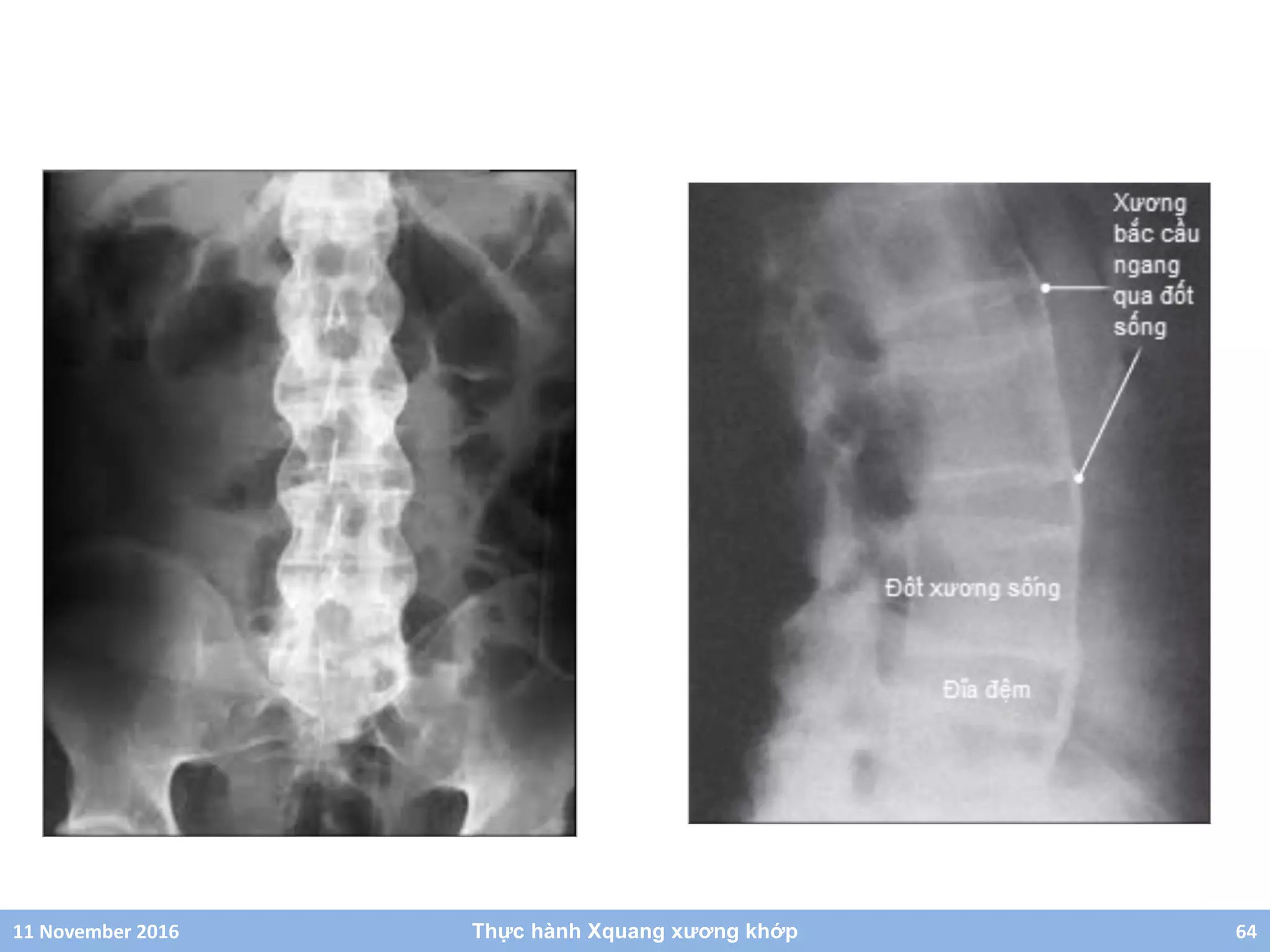 Thực hành X quang xương khớp | PDF
