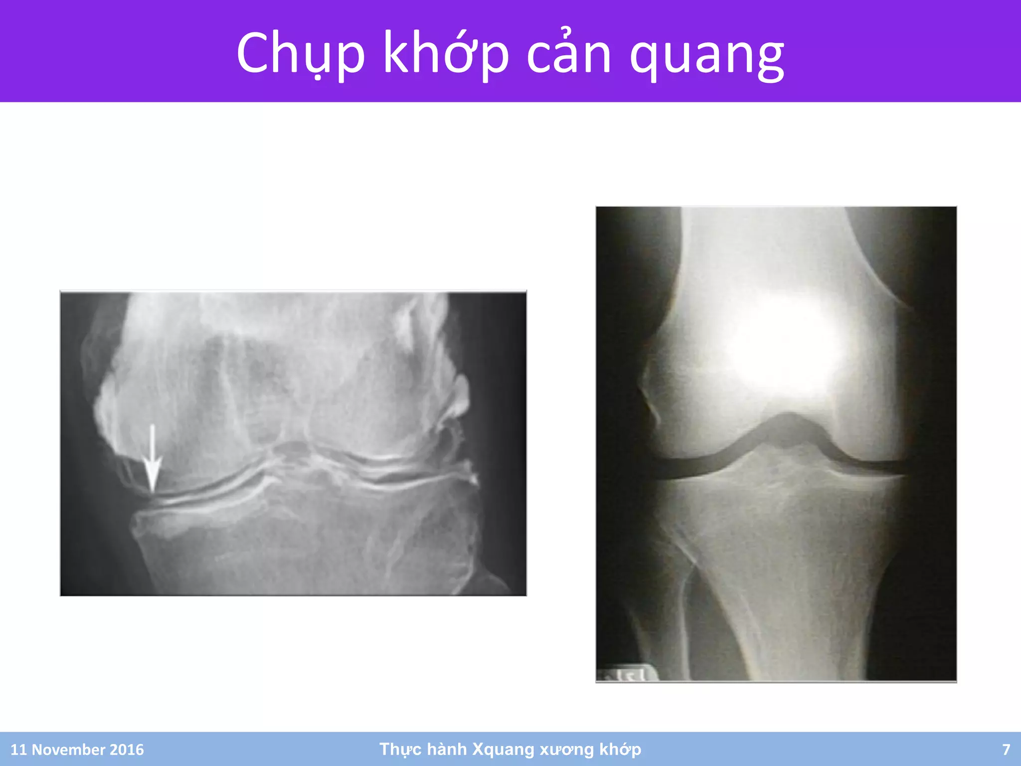Thực hành X quang xương khớp | PDF