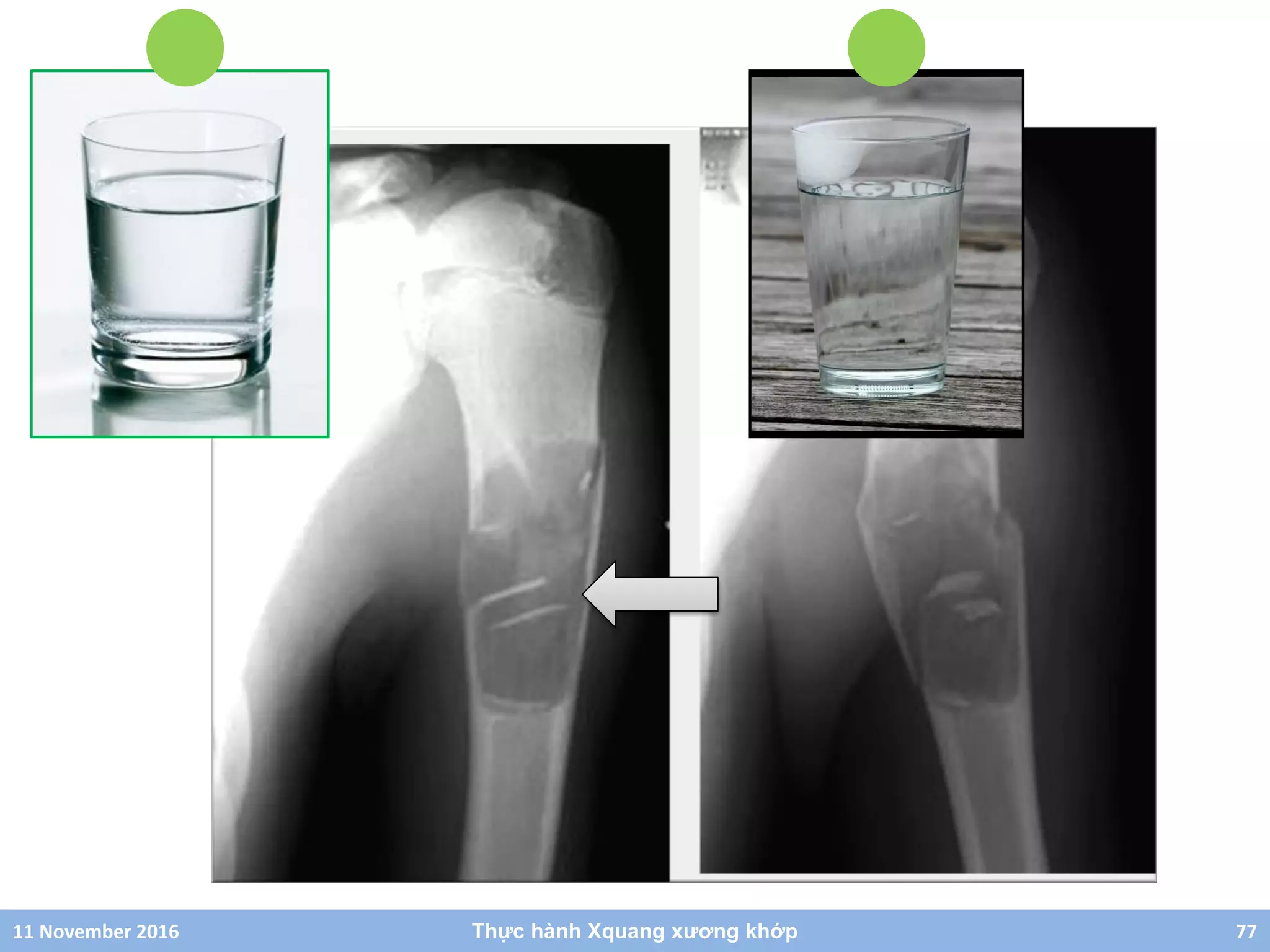 Thực hành X quang xương khớp | PDF