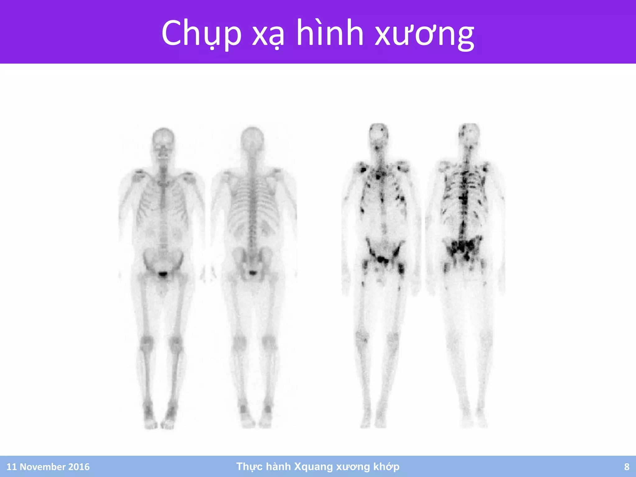 Thực hành X quang xương khớp | PDF