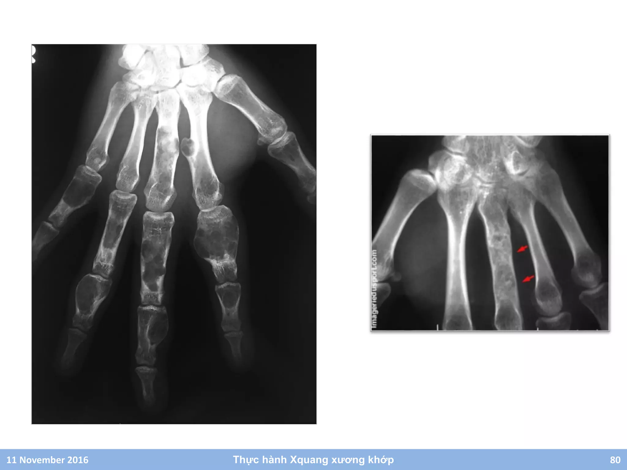 Thực hành X quang xương khớp | PDF