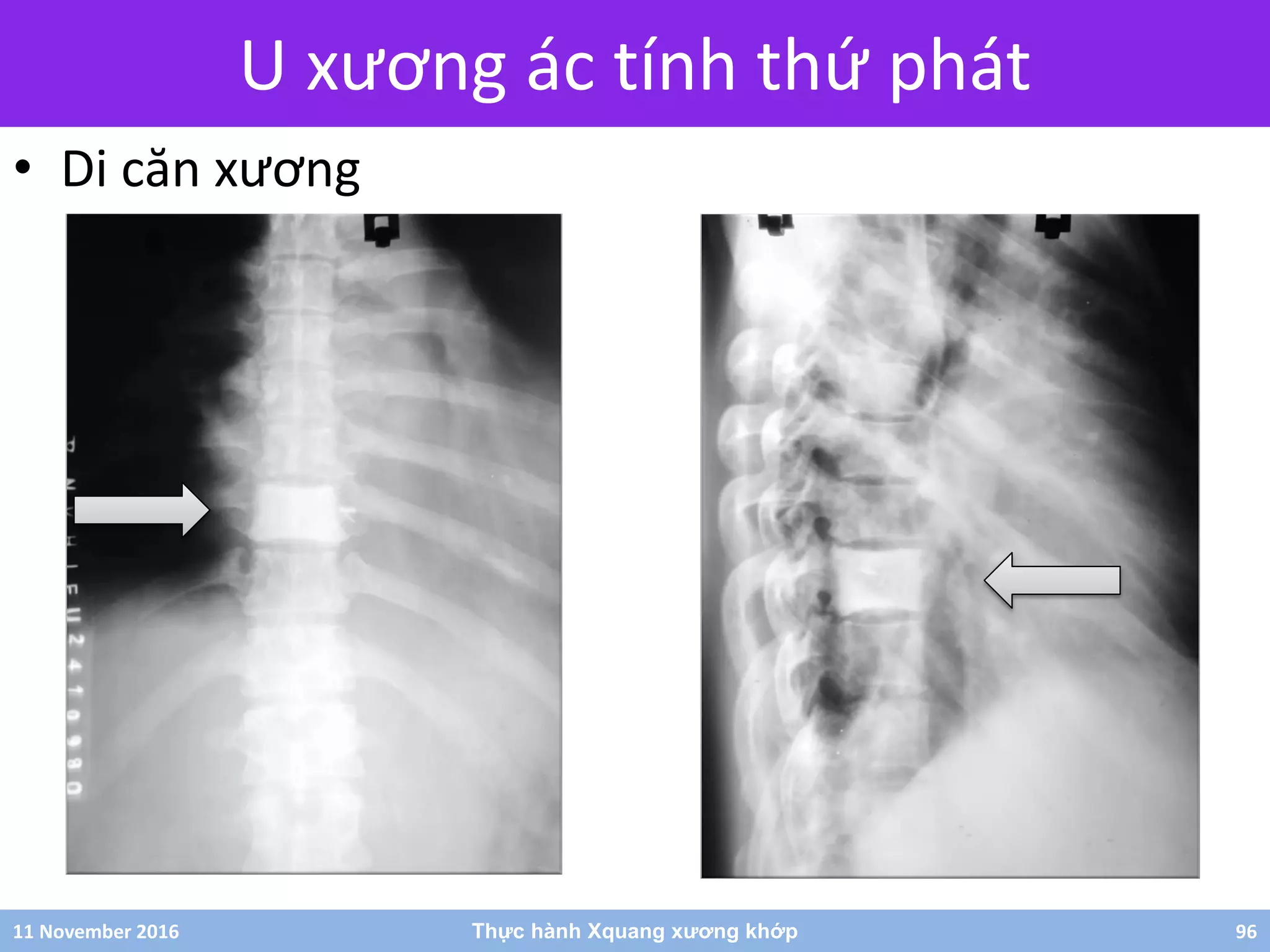 Thực hành X quang xương khớp | PDF