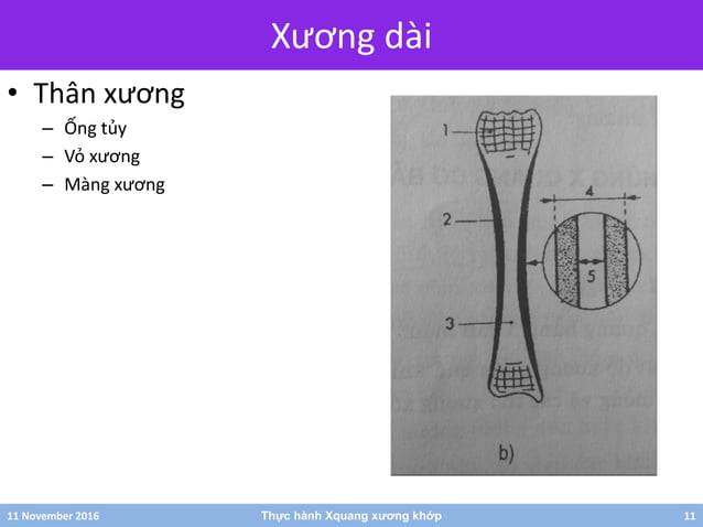 Thực hành X quang xương khớp | PDF