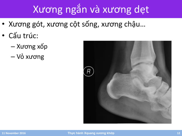 Thực hành X quang xương khớp | PDF