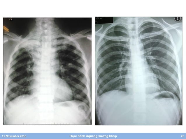 Thực hành X quang xương khớp | PDF