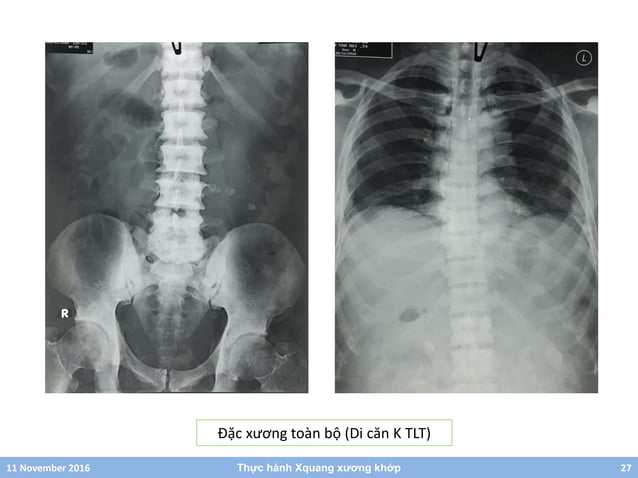 Thực hành X quang xương khớp | PDF