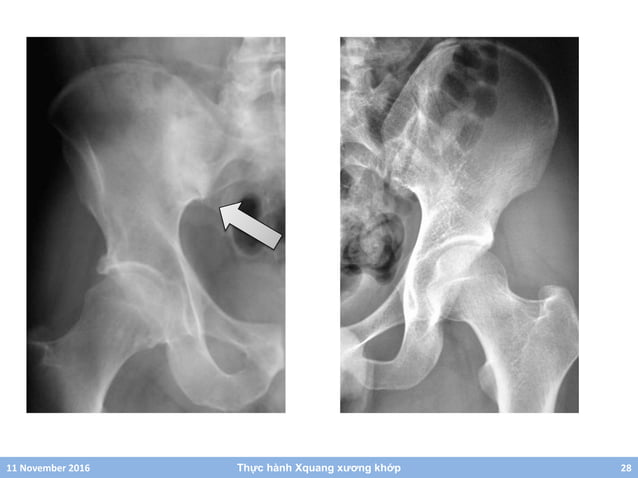 Thực hành X quang xương khớp | PDF
