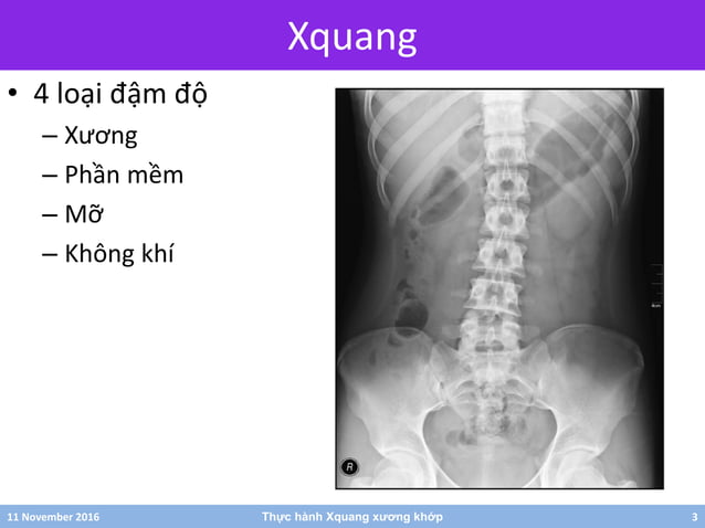 Thực hành X quang xương khớp | PDF