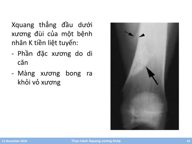 Thực hành X quang xương khớp | PDF