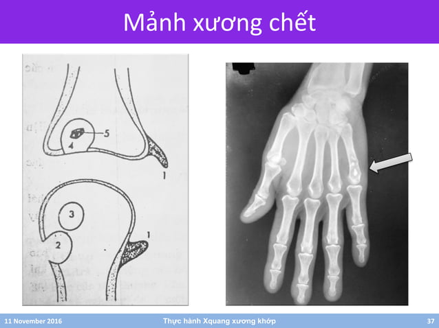 Thực hành X quang xương khớp | PDF