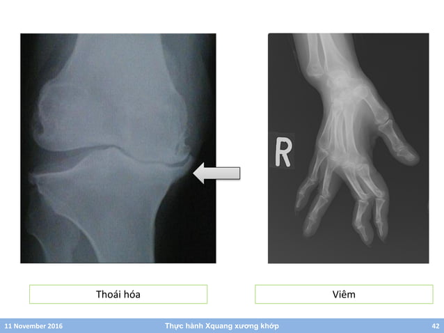 Thực hành X quang xương khớp | PDF