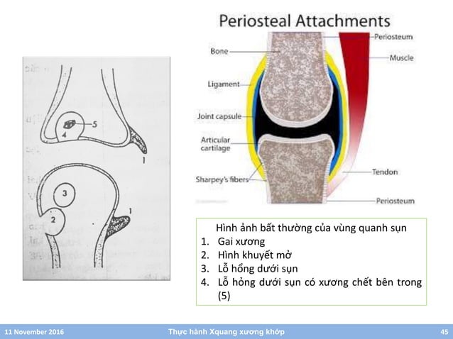 Thực hành X quang xương khớp | PDF
