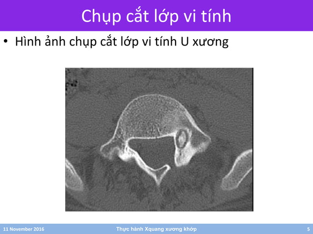 Thực hành X quang xương khớp | PDF