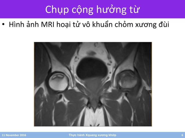 Thực hành X quang xương khớp | PDF