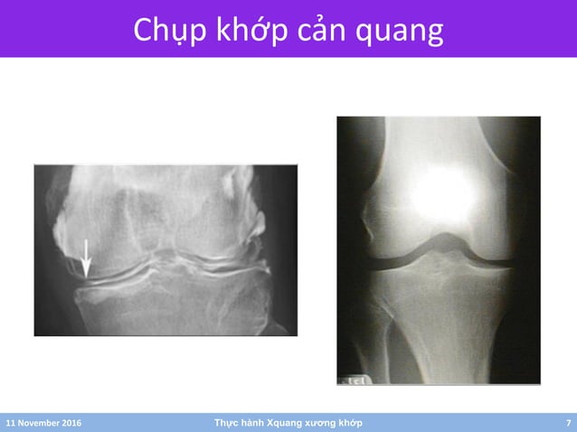 Thực hành X quang xương khớp | PDF