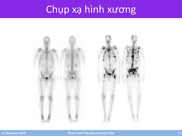 Thực hành X quang xương khớp | PDF