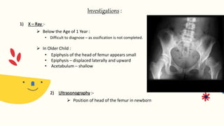 Congenital Dislocation of the Hip - PHYSIOTHERAPY | PPTX
