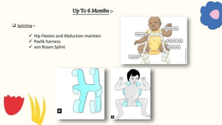 Congenital Dislocation of the Hip - PHYSIOTHERAPY | PPTX