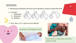 Congenital Dislocation of the Hip - PHYSIOTHERAPY | PPTX