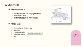 Congenital Dislocation of the Hip - PHYSIOTHERAPY | PPTX