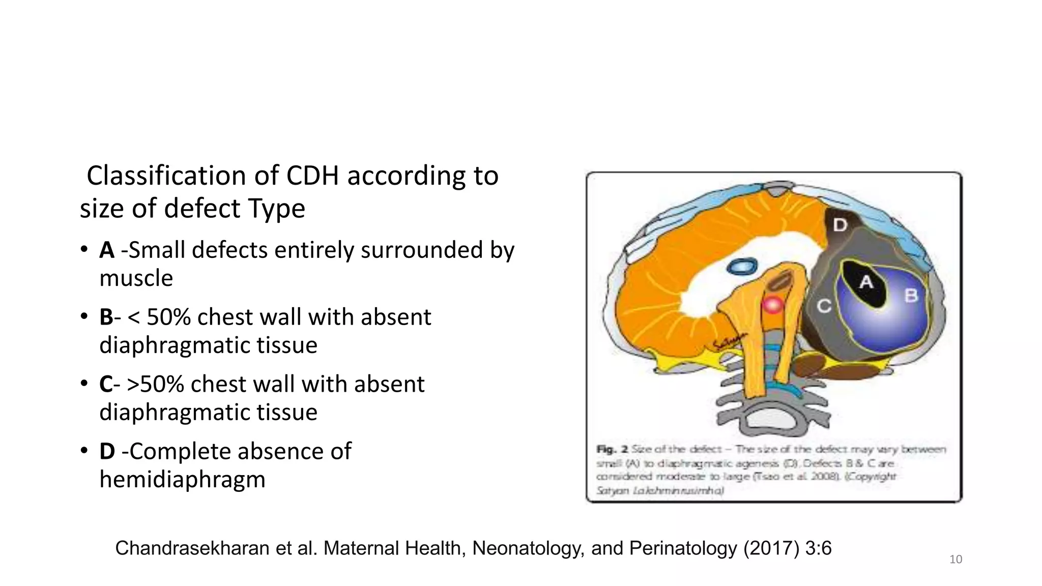 Anesthesia For Congenital Diaphragmatic Hernia | PPTX