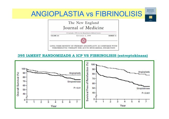 Código infarto 2 | PDF