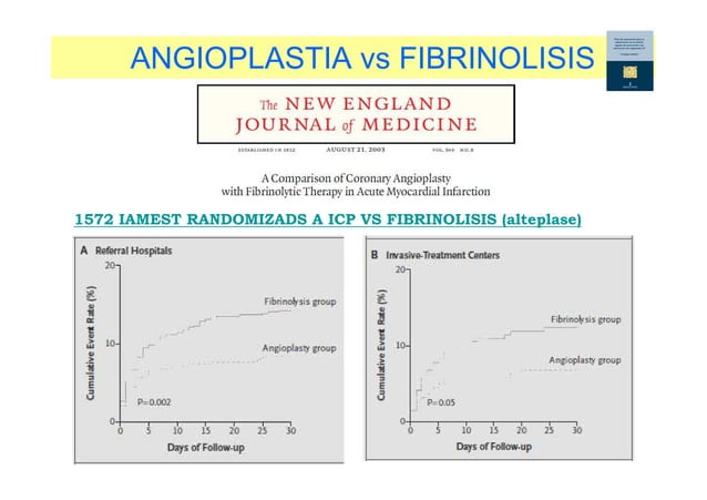 Código infarto 2 | PDF