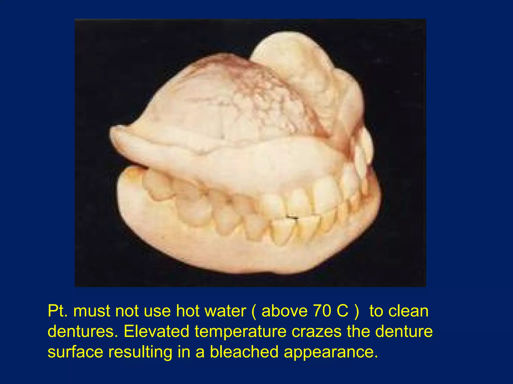 Complete Denture insertion | PPT