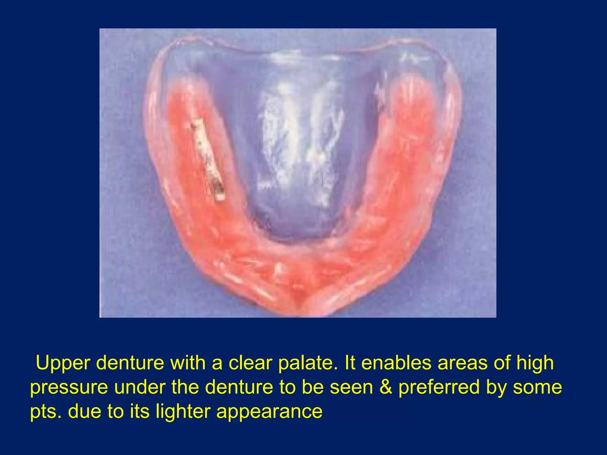 Complete Denture insertion | PPT