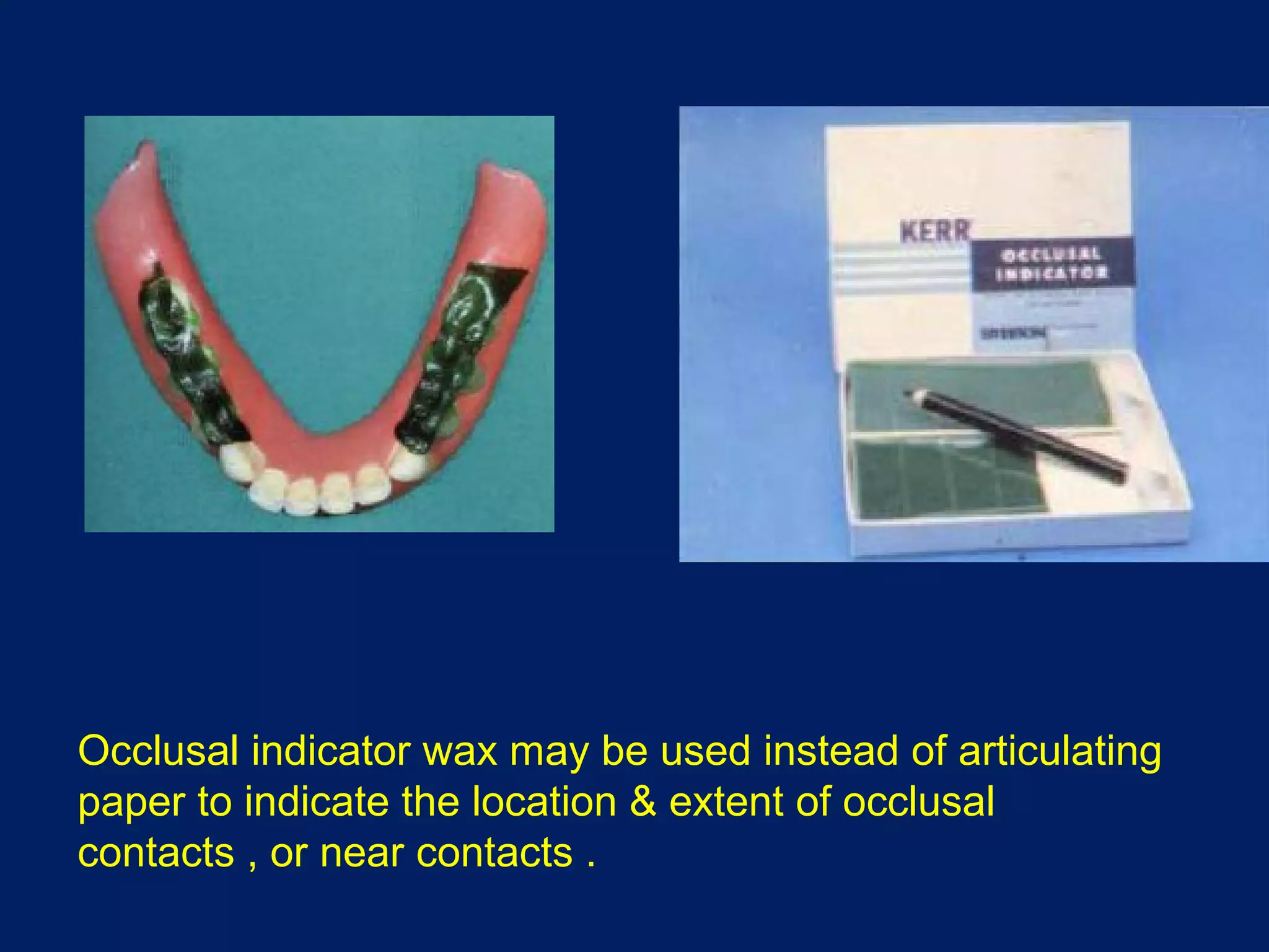 Complete Denture insertion | PPT
