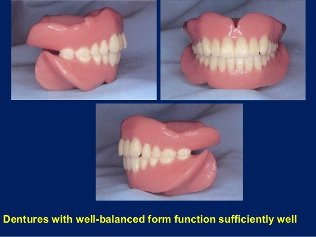 Complete Denture insertion