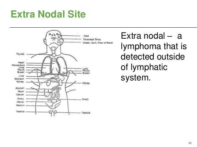 CDISC journey using Cheson 2007
