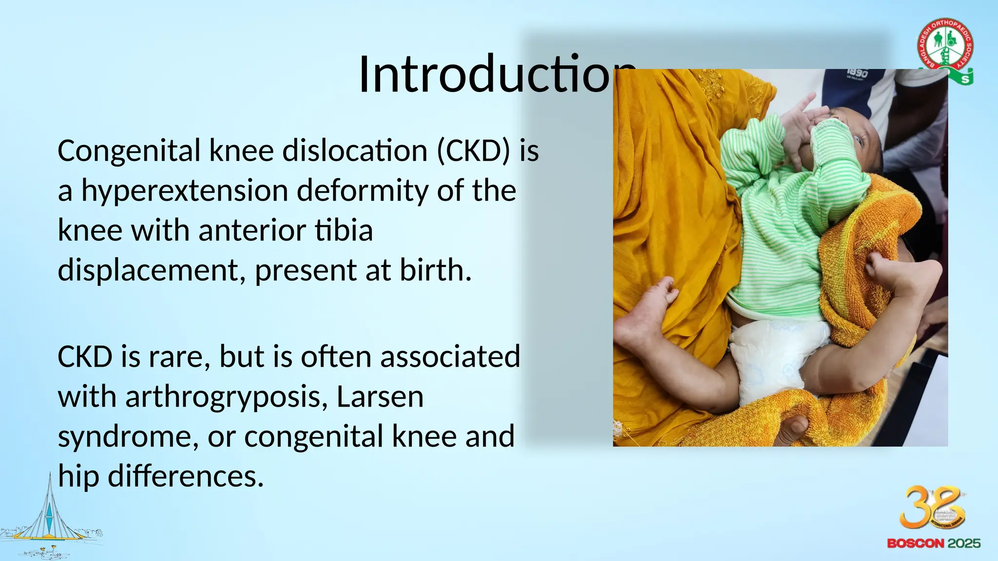 Congenital dislocation of knee- The efficacy of treatment-pptx | PPTX
