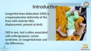 Congenital dislocation of knee- The efficacy of treatment-pptx | PPTX