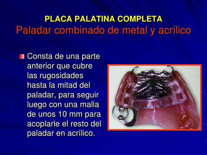 Conectores mayores y apoyos