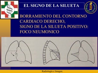 EL SIGNO DE LA SILUETA | PDF