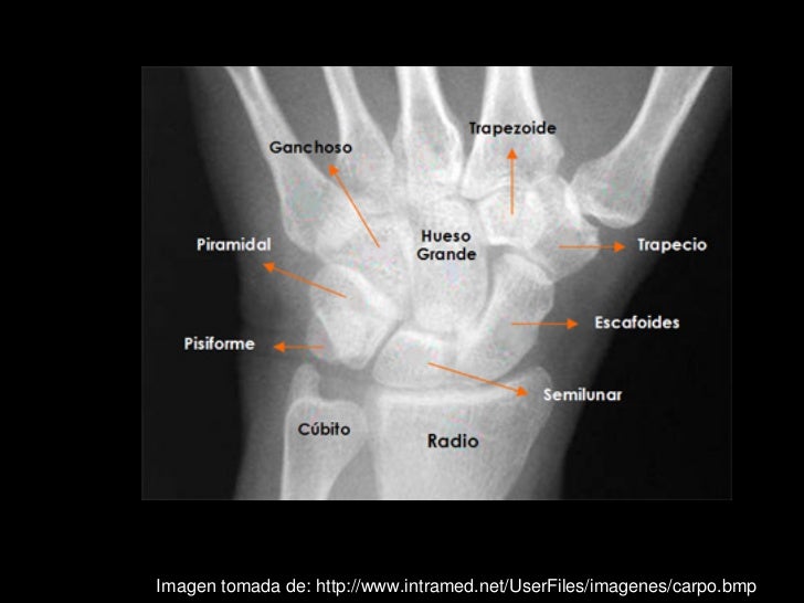RADIOGRAFIA CARPAL