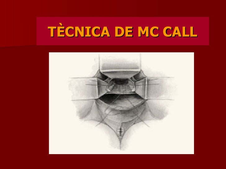 PROLAPSO GENITAL FEMENINO Y LOS DEFECTOS DEL DEGMENTO APICAL