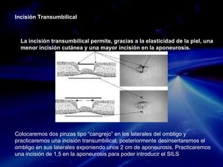 Colecistectomía transumbilical. SILS. Técnica Quirurgica | PPT