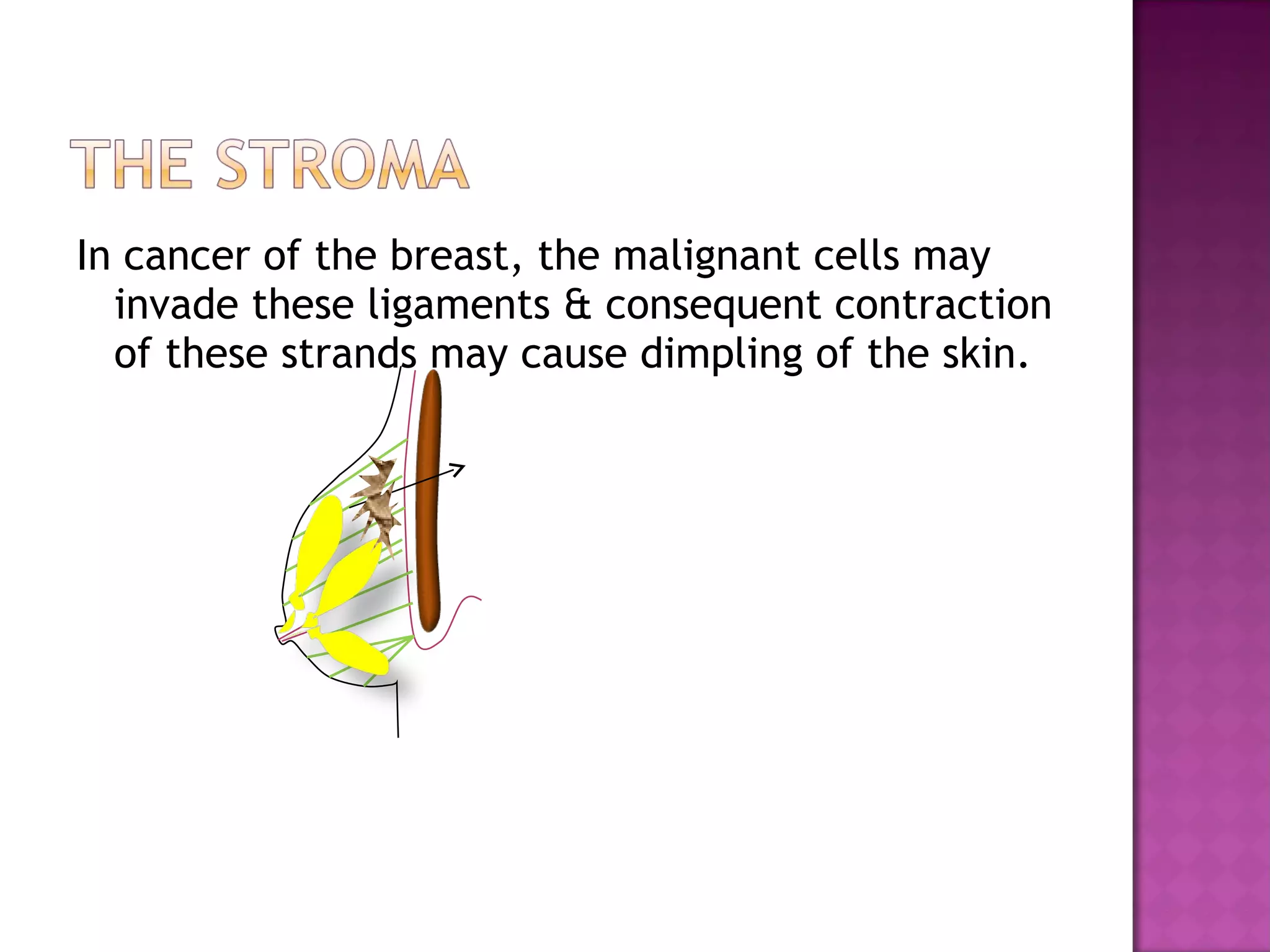 surgical anatomy of breast & management of advanced carcinoma breast | PPT