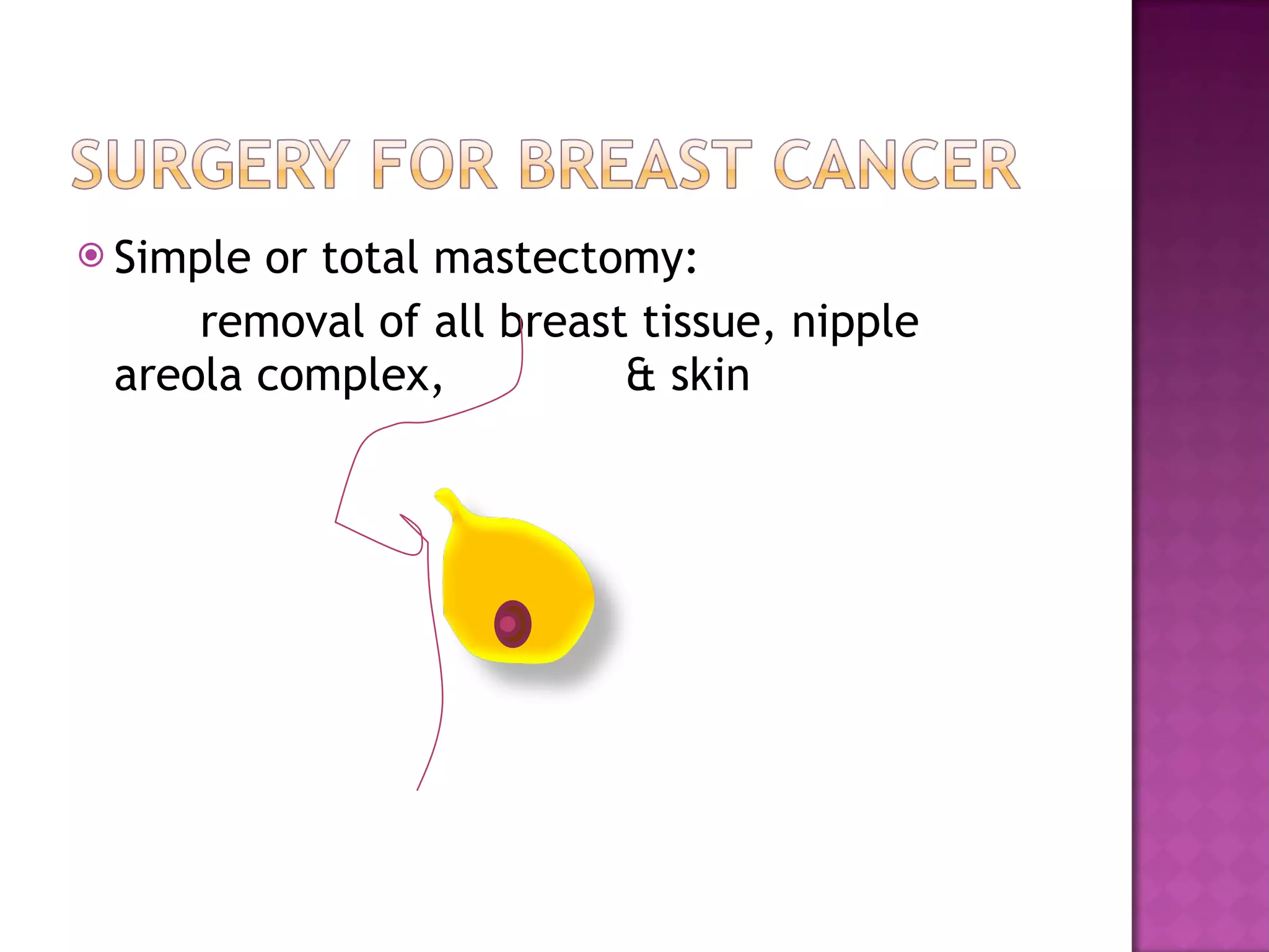 surgical anatomy of breast & management of advanced carcinoma breast | PPT