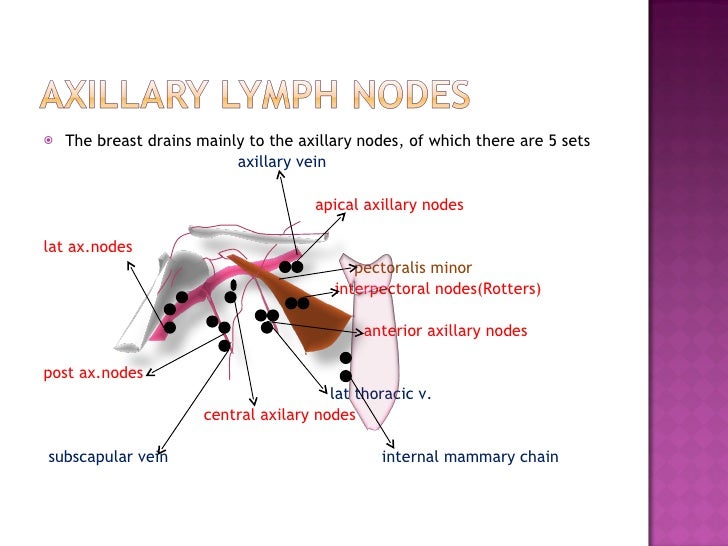 surgical anatomy of breast & management of advanced carcinoma breast